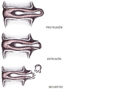Rehabilitación GDL: REHABILITACIÓN DEL CUELLO