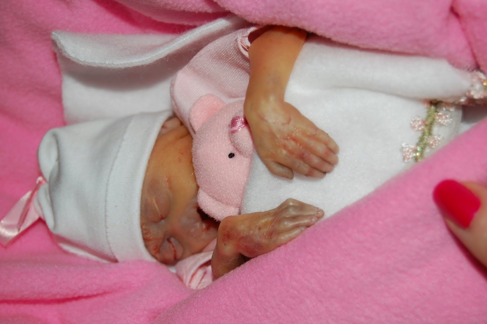 Hannah: 13 Stories of Trisomy 13 | Still Playing School