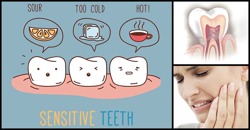 Kitchen Remedies That Help Alleviate Pain From Sensitive Teeth | Dr ...