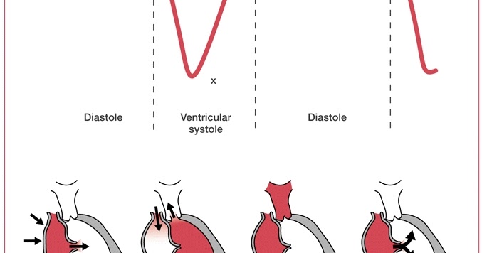 Jugular Venous Pressure Waveform | INA - ECG