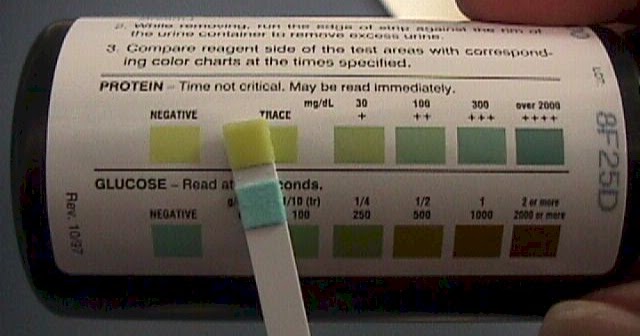 My IVF ICSI - 我的试管婴儿: 28 Weeks - Tetanus Toxoid (TT) Vaccine (1st ...