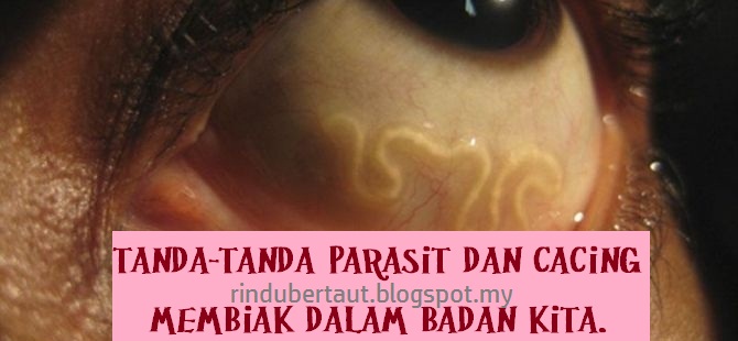 Tanda-Tanda Parasit dan Cacing Membiak Di Dalam Badan Kita | Explorasi ...