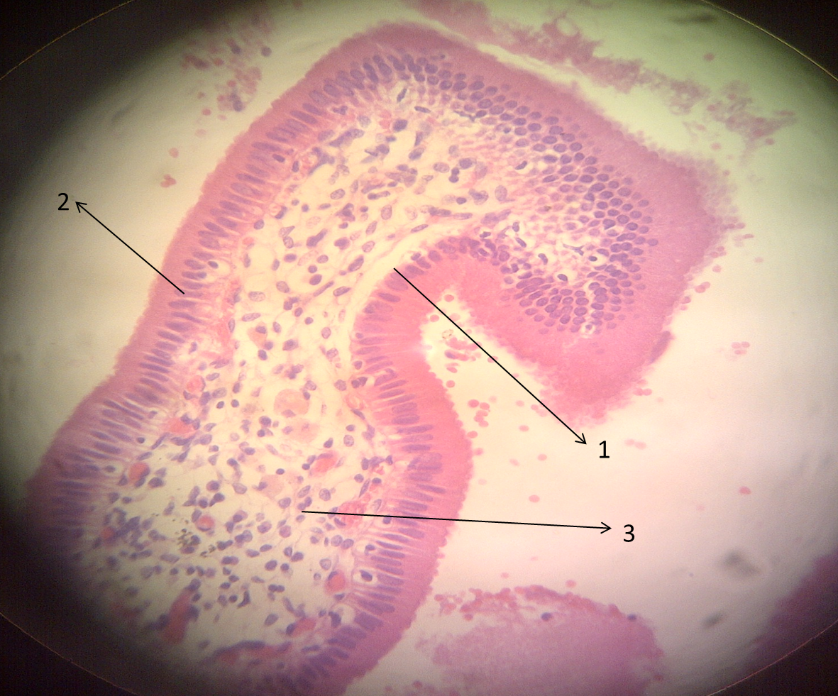 primeros pasos en medicina : Epitelio cilíndrico simple