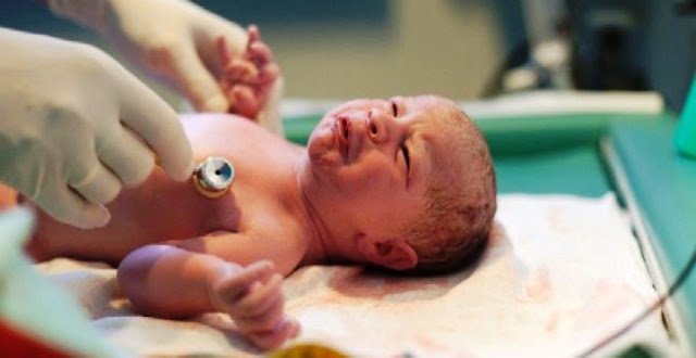 CARACTERISTICAS DEL NEONATO - BIENVENIDOS