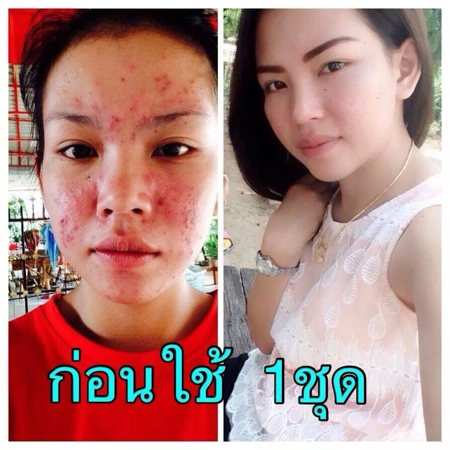 Freshy Face Gold Set Thailand