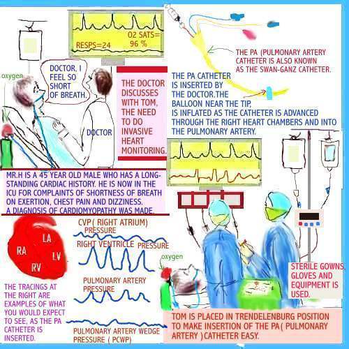 Dear Nurses: HEMODYNAMIC MONITORING - WHAT IS IT