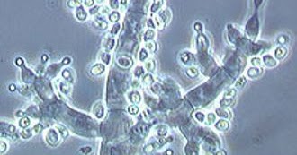 4 Cara Aplikasi dan Manfaat Trichoderma Sebagai Jamur Antagonis Pada ...