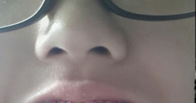 ♛Geraldine Yan♛: MY "BRACES" JOURNEY PART 1