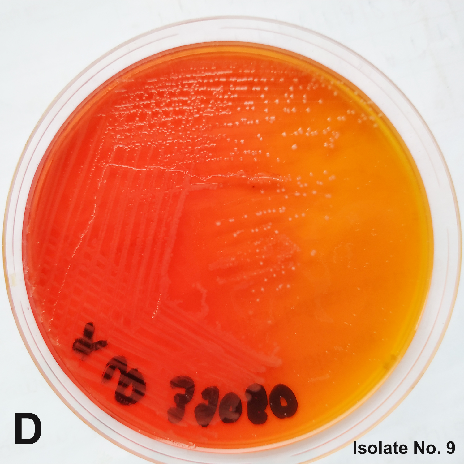 MICROBIOLOGY BLOG FOR STUDENTS (MBLOGSTU): Cultural and Biochemical ...