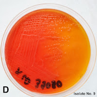 MICROBIOLOGY BLOG FOR STUDENTS (MBLOGSTU): Cultural and Biochemical ...