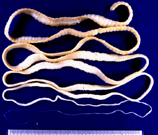 CESTODOS: TAENIA SOLIUM: Generalidades