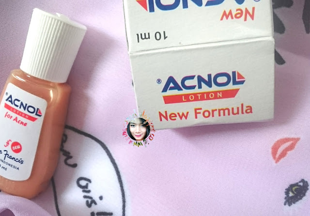 Review Acnol Lotion for Acne