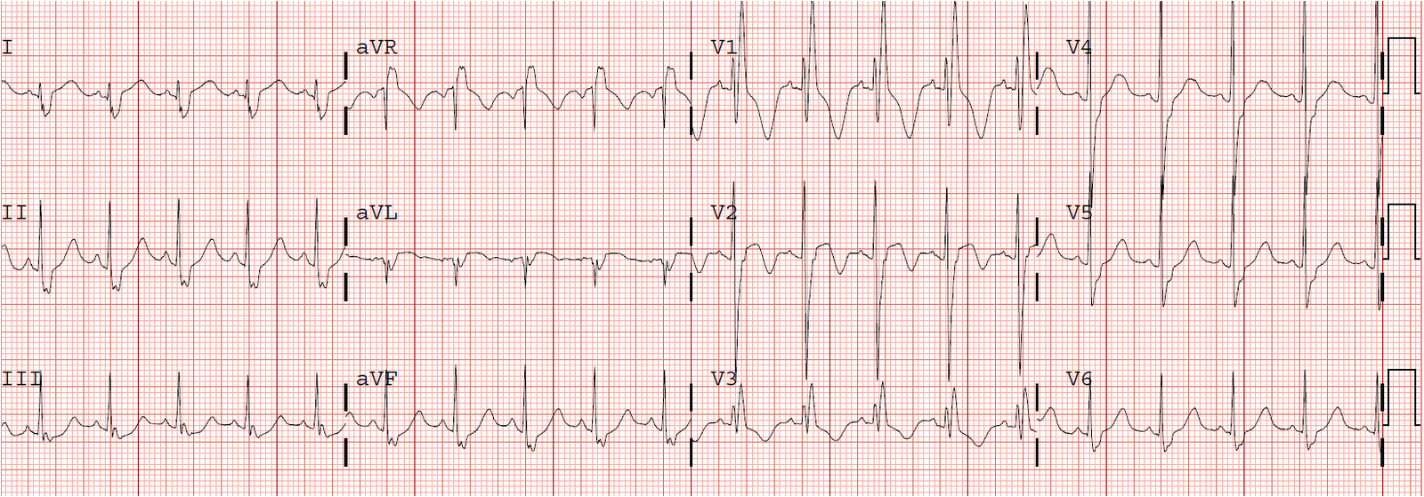 Dr. Smith's ECG Blog: July 2012