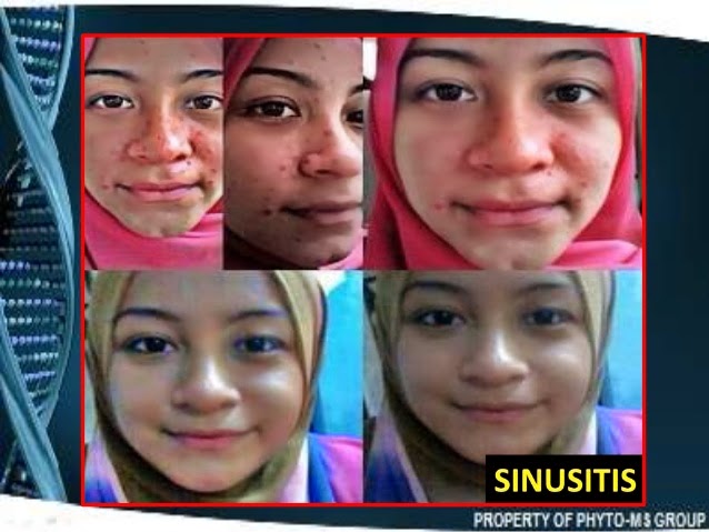 Phyto Science Stem Cell: Testimony for PhytoScience Double Stem Cell