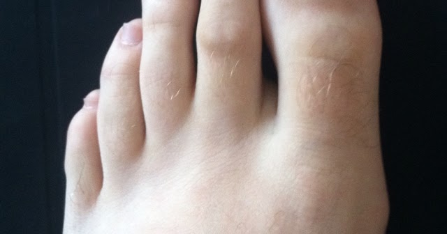 Pentru Suflet: Iata ce inseamna daca degetul aratator de la picior este ...