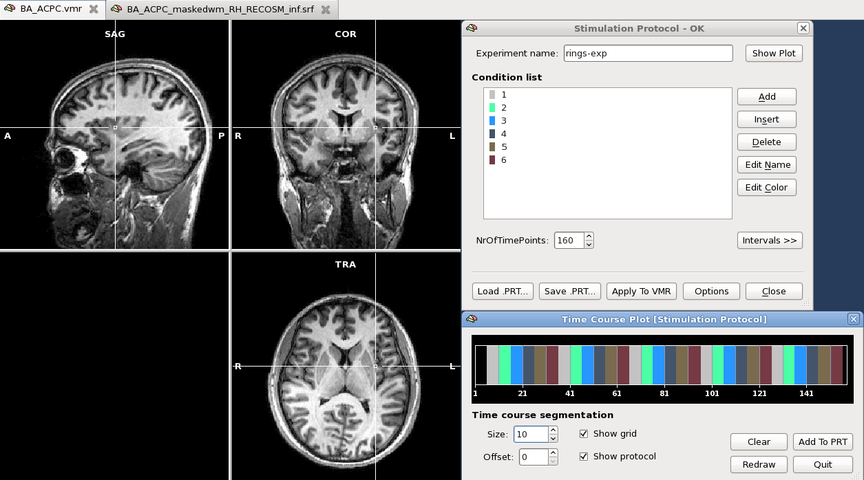 Retinotopy Analysis with BrainVoyager – Computational and Biological ...