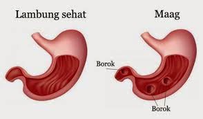 Fakta Tentang Lambung Manusia | junetz_zone_sty