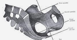 Kebidanan Full: Cara Menentukan Bidang Hodge pada Panggul Ibu