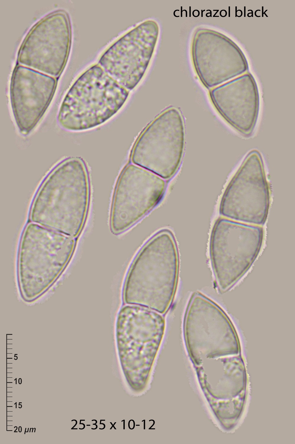 Juglanconis juglandina (Kunze) Voglmayr & Jaklitsch • CEMAS Hongo ...