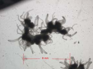 Parasitophilia: Parasitic Jellyfish?!?!?! Meet Polypodium hydriforme!