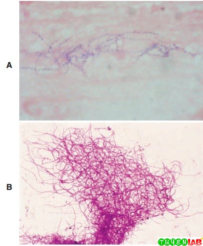 [Microbiology] Atlas of Aerobic Gram-Positive Bacilli | Free Medical Atlas