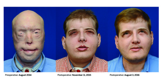 Plastic and Cosmetic Surgery: Science Celebrates Success of Incredible ...