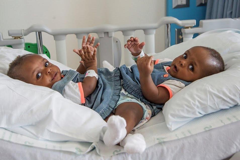 Photos/Video: Conjoined Nigerian twins successfully separated at U.S ...