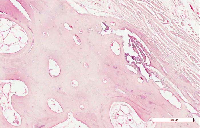 Álbum Histologico : Tejido Oseo