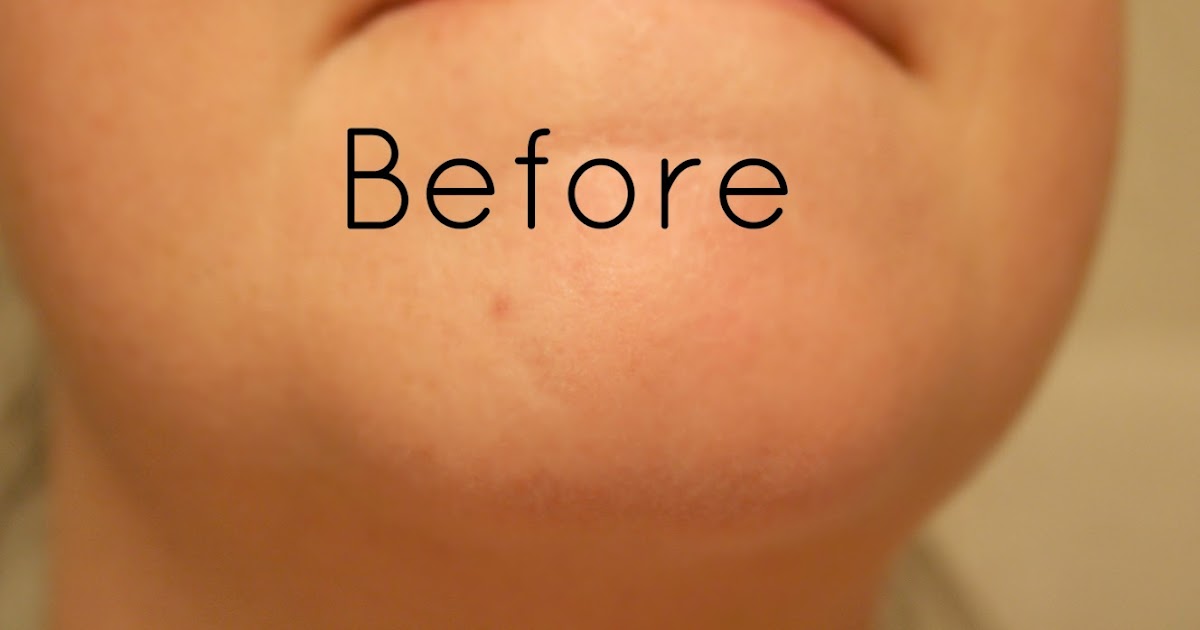 Elle Sees|| Beauty Blogger in Atlanta: How To: Hide a Pimple (Using ...