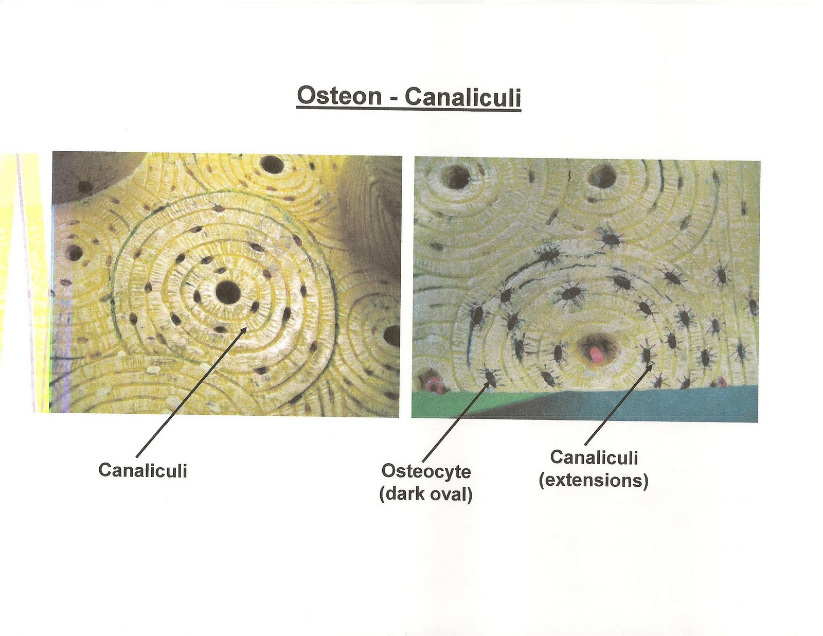 ANATOMY & PHYSIOLOGY I BIS 240: Osteon-Canaliculi