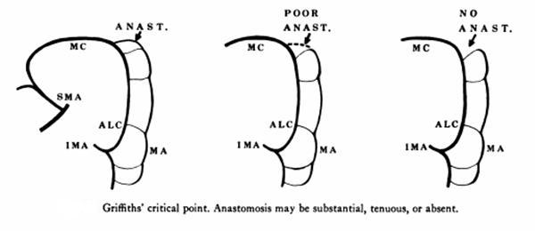 The Pump and the Tubes: Griffith's Point