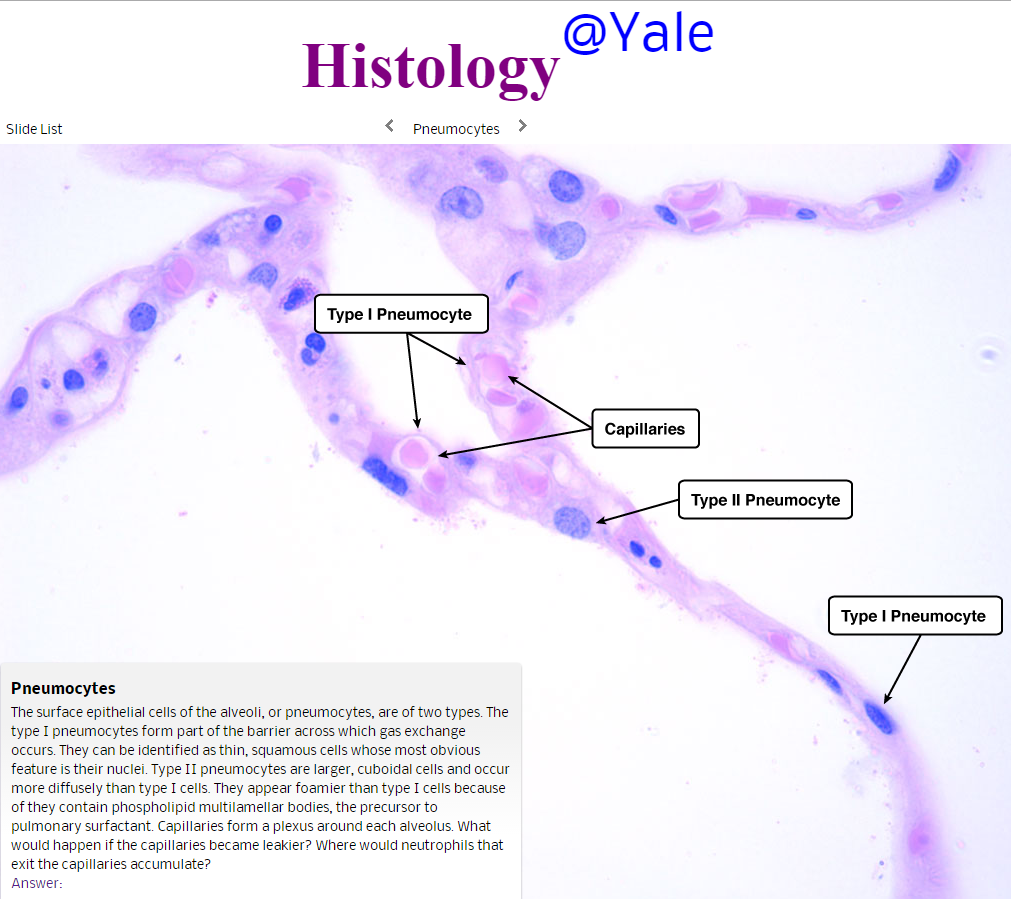 VDU's blog: March 2016
