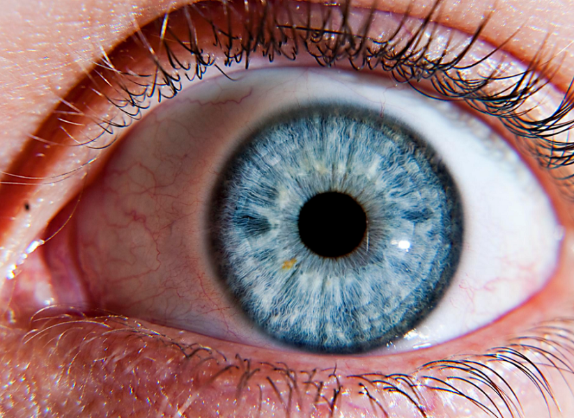 Penyakit Glaukoma: Pengertian Glaukoma