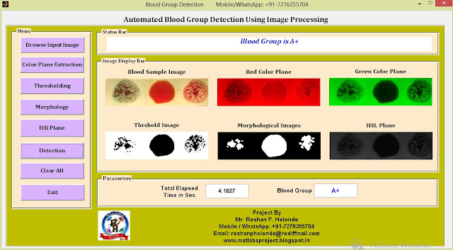 Skin Disease Detection And Classification Using Image Processing Matlab