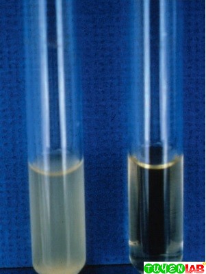 [Microbiology] Atlas of Vibrio, Aeromonas, Plesiomonas, and ...