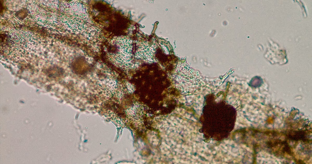 University of Illinois Plant Clinic: Red Root Rot of Corn being ...