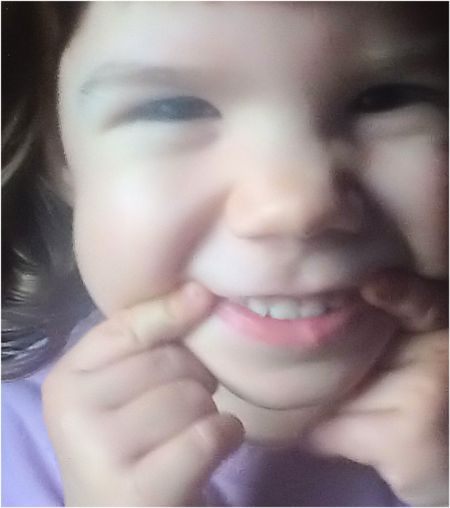 My Daughter's Perfect Smile {Baby-G's Split Lip, A Year Later} - Maple ...