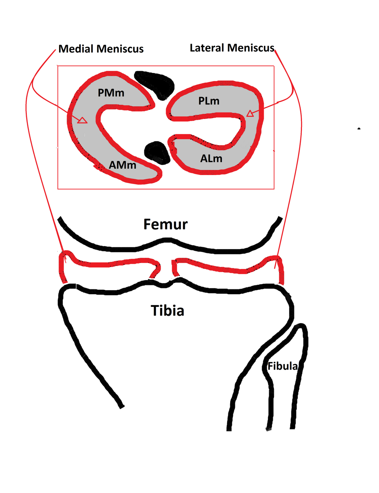 Dr. David Kwon's Blog: Ouch My Knee!! [Part 5] From Joe Shmo to Joe ...