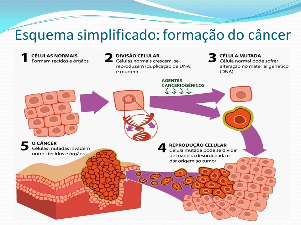 Dilmara - Cuidados Especiais: O que é Câncer