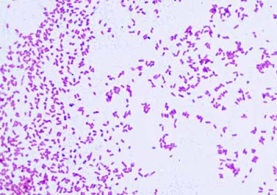 What is gram-negative bacteria? ~ Biological Science Help Blog ...