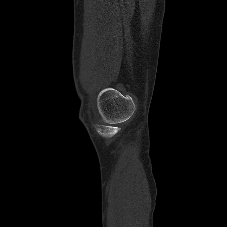 CT Knee - Radiology Imaging