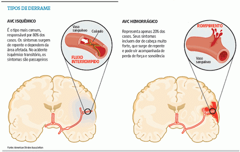 saúde de A a VaZ: AVC