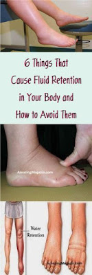 6 Things That Cause Fluid Retention in Your Body and How to Avoid Them ...