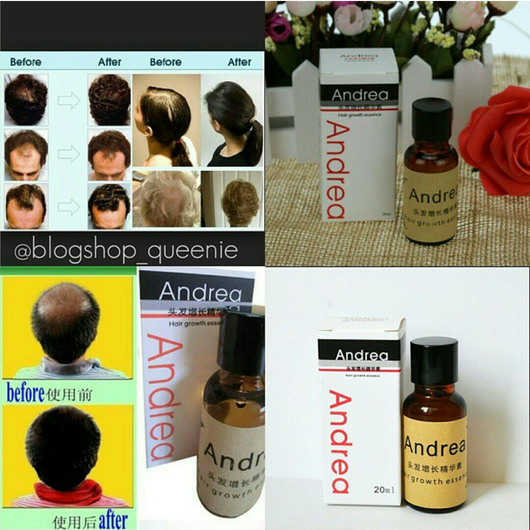 Blogshop_Queenie Catalogue: Andrea Hair Growth Essence