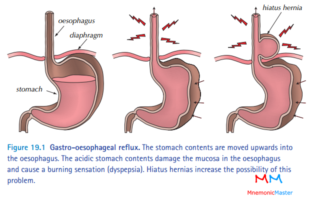 Learn From Images Part 10 (Gastrointestinal) |MEDICALBOOKREADER