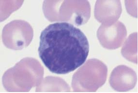 [Haematology] Normal Cells of the Blood and Hematopoietic Organs | Free ...