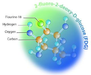 Fluorine-18, ^18F: Fluorine 18 use in Nuclear Medicine