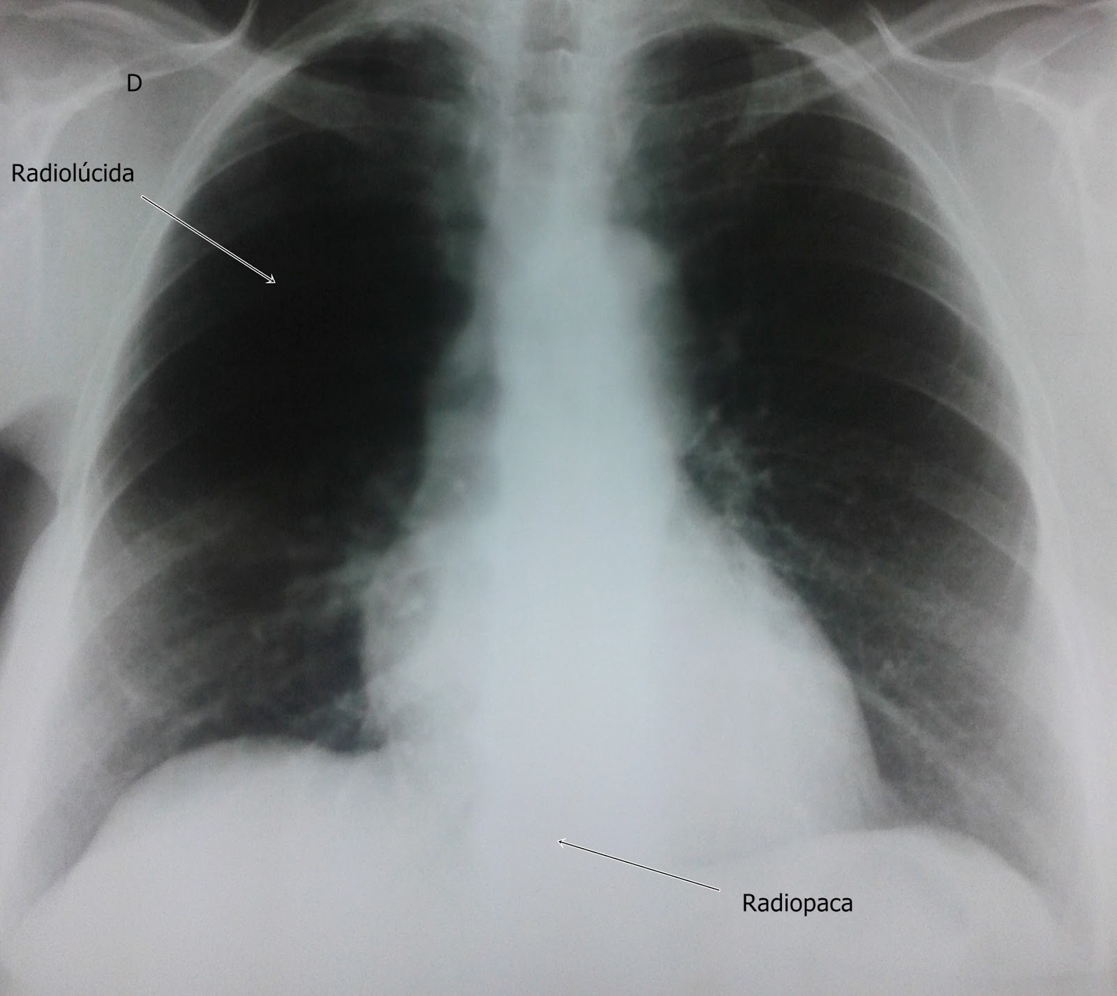 DICAS DE RADIOLOGIA: REVELAÇÃO DE RAIO X - PROCESSAMENTO RADIOGRÁFICO ...