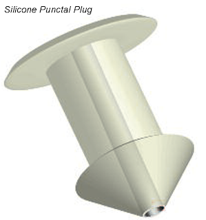 Tear Duct Plugs - My Experience: Dry Eye Syndrome ...