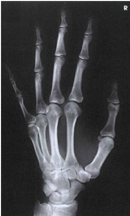 Study of the Hand | Radiology